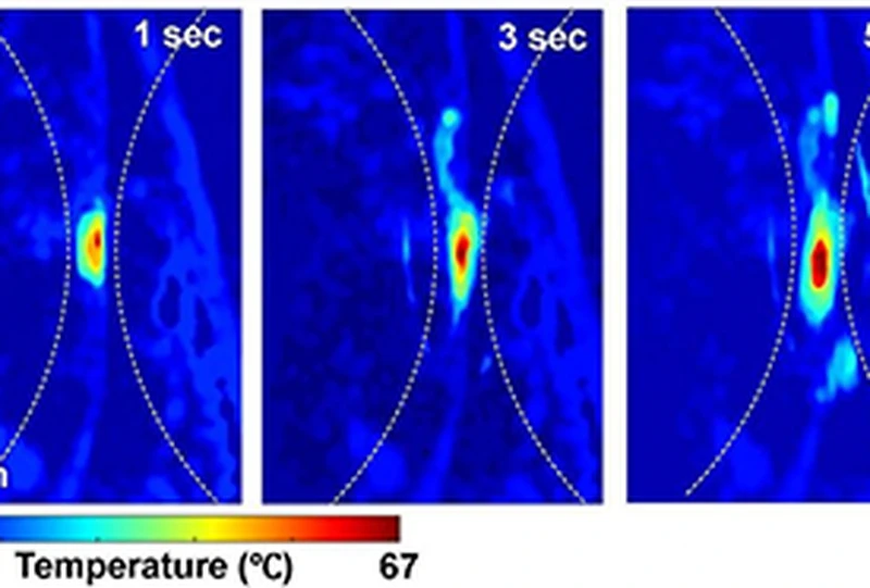 Non-Invasive Imaging Technique Could Significantly Improve Cancer ...